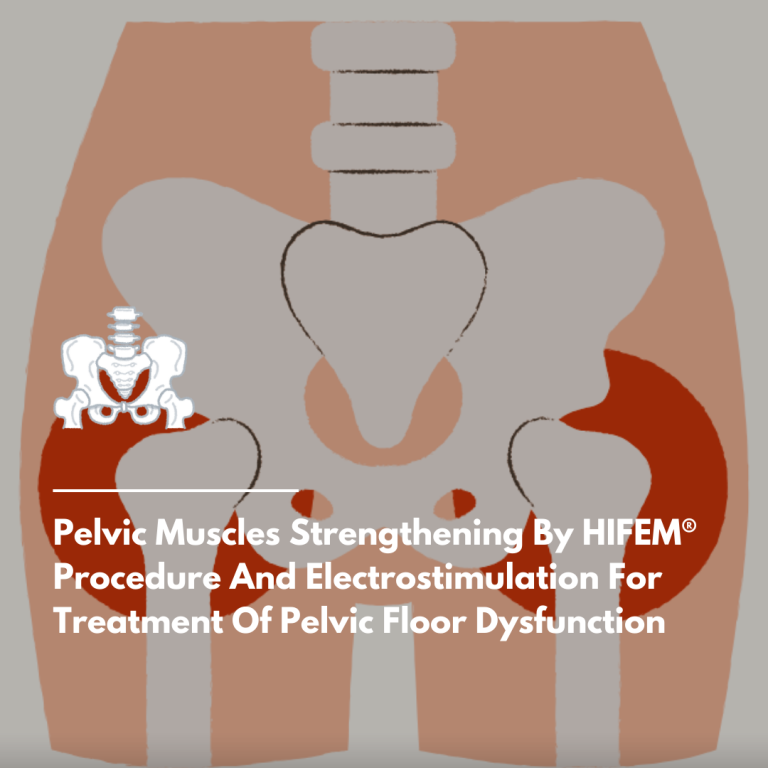 HIFEM® For Treatment Of Pelvic Floor Dysfunction